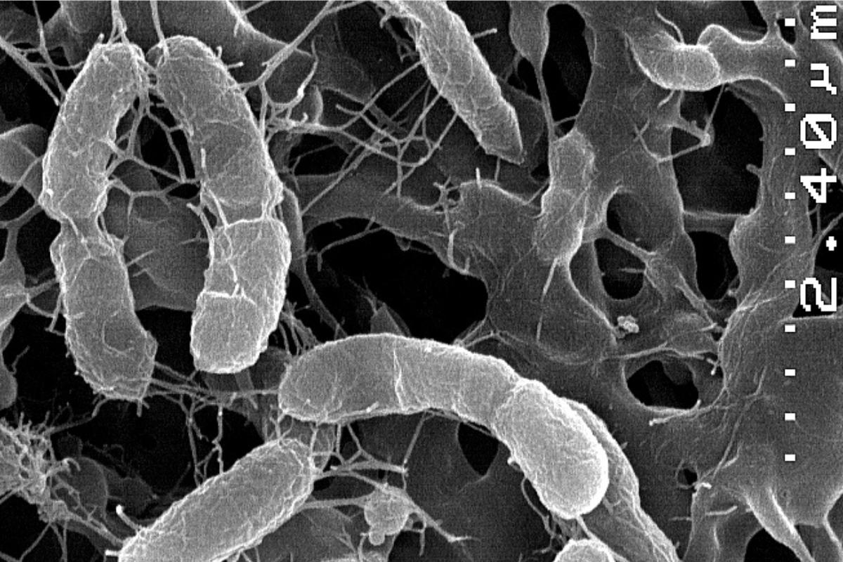 Quimiosíntesis: qué es, fases y organismos - Resumen