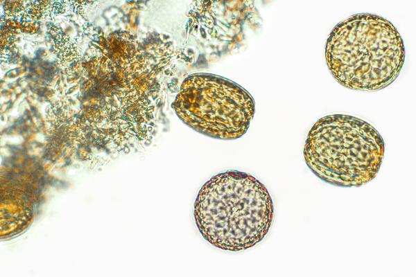 Algas diatomeas: qué son, características y para qué sirven - Resumen