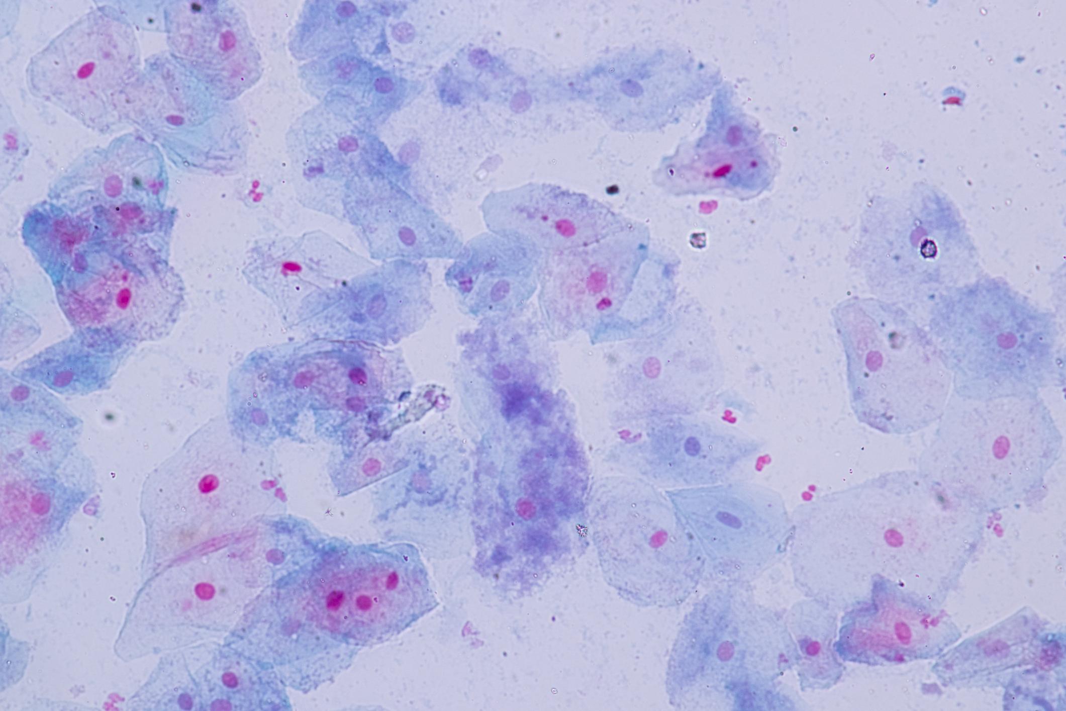 Células epiteliales: qué son, funciones y tipos - Resumen para estudiar