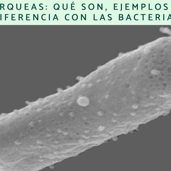 Ejemplos De Eubacterias Eubacteria Definition And Examples Biology