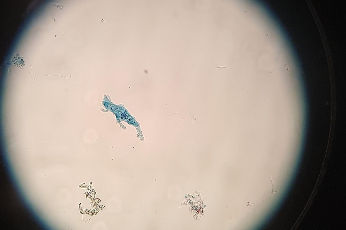 Arqueas: qué son, ejemplos y diferencia con las bacterias - Resumen